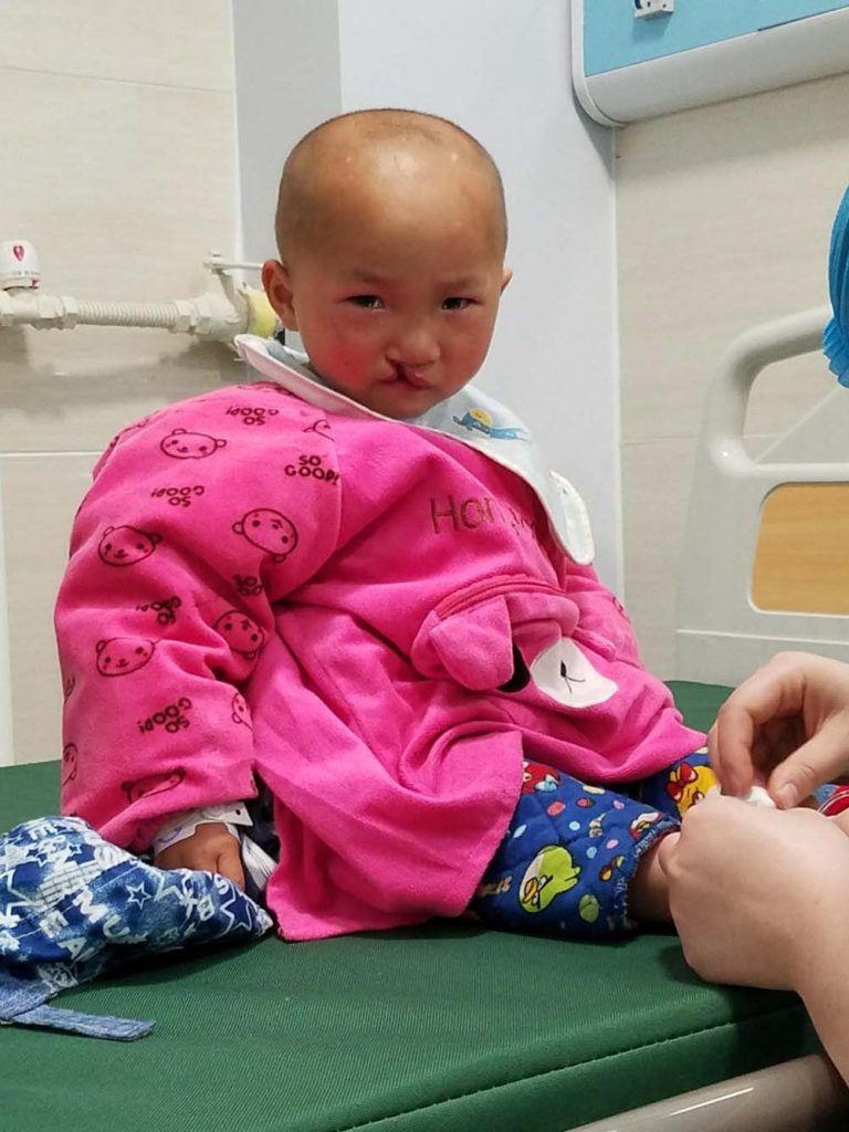 Soothing a Scared Little Girl Before Her Surgery – Alliance for Smiles